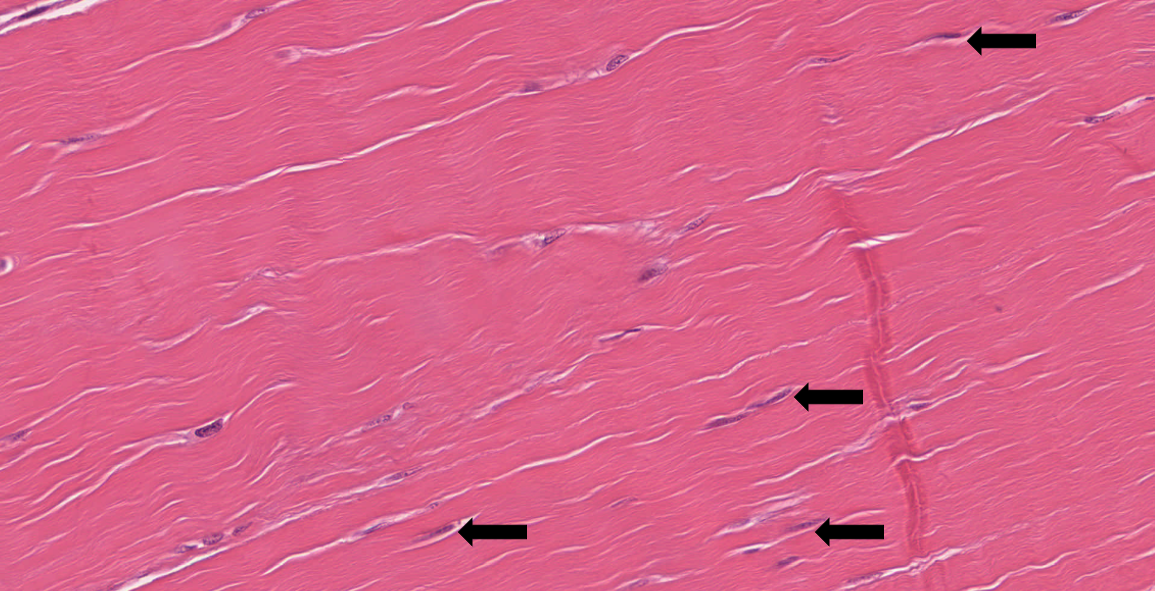 Tejido Conectivo Denso Regular