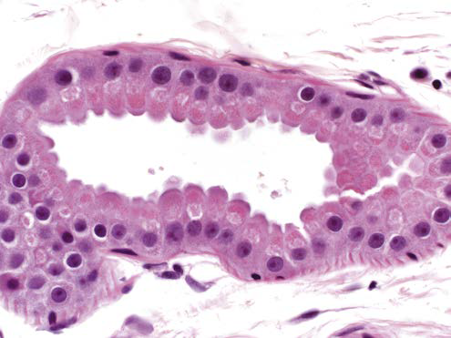 Histologia Das Glandulas Sudoriparas Ecrinas Vs Apocrinas 15 12 Pele