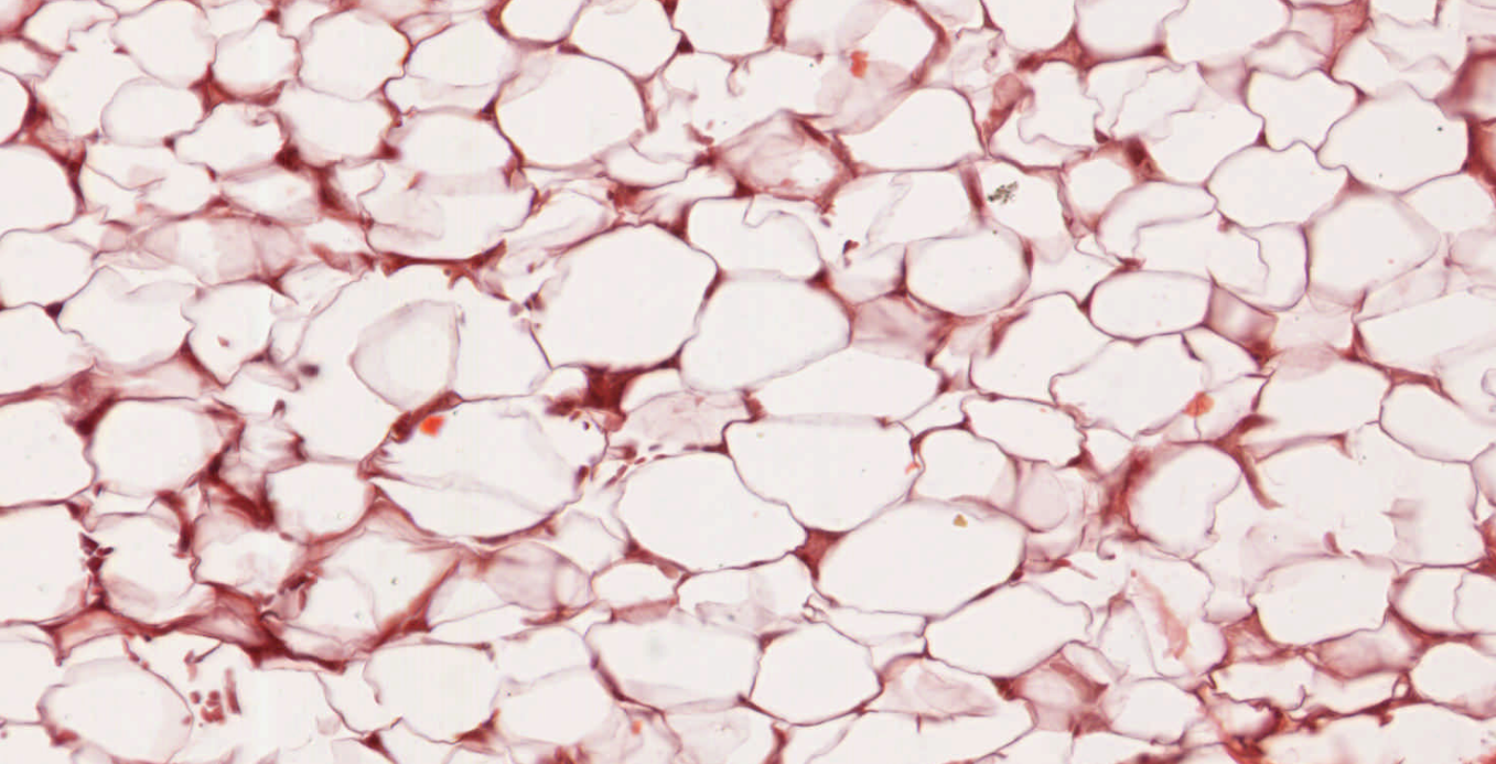 Anatomía Del Tejido Adiposo Spanish HIE Multimedia Biopsia De