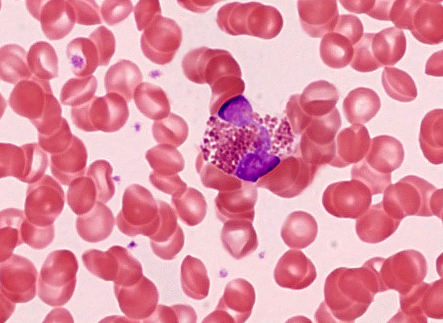 Histología De Los Megacariocitos Linfocitos: Histología | Concise