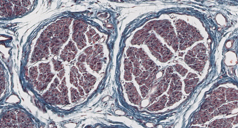 T. MUSCULAR – ATLAS DE HISTOLOGÍA