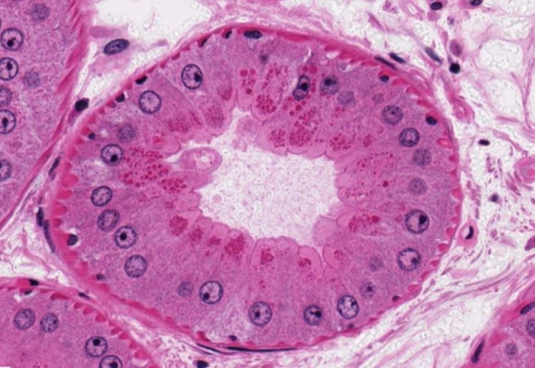 GLÁNDULAS – ATLAS DE HISTOLOGÍA