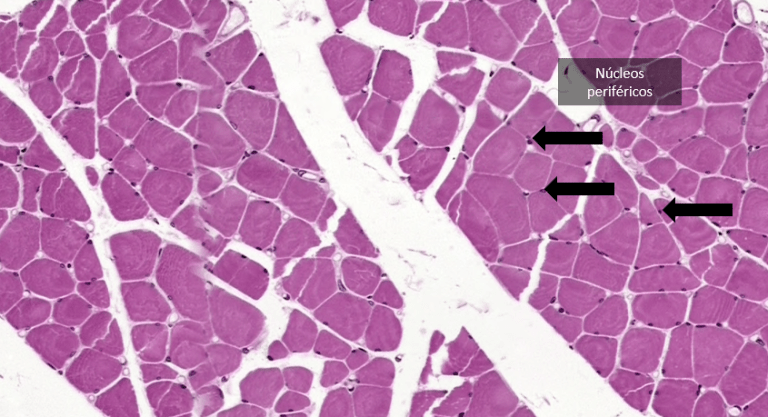 T Muscular Atlas De Histología
