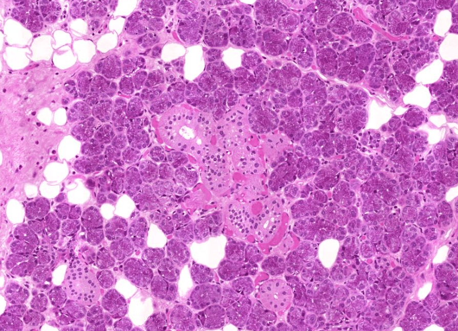 Histología De La Glándula Salival Submandibular Etiquetada
