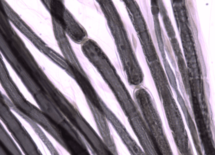 T. NERVIOSO – ATLAS DE HISTOLOGÍA
