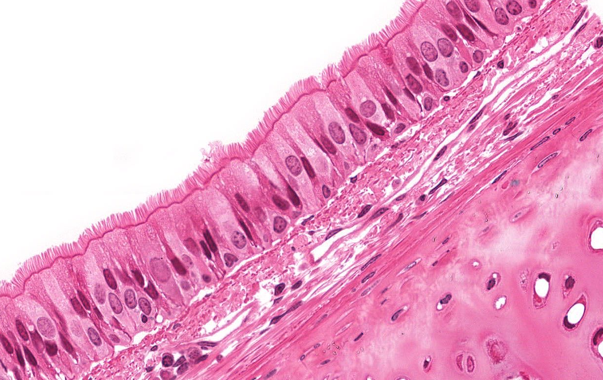 Portaobjetos De Histología De La Tráquea
