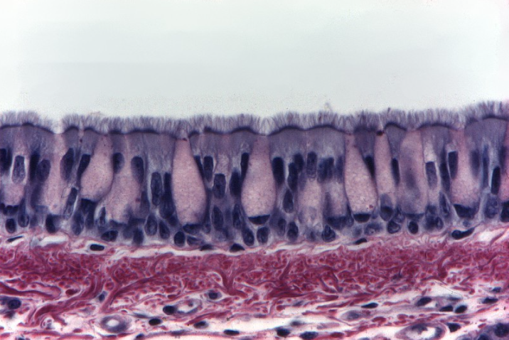 Portaobjetos De Histología De La Tráquea