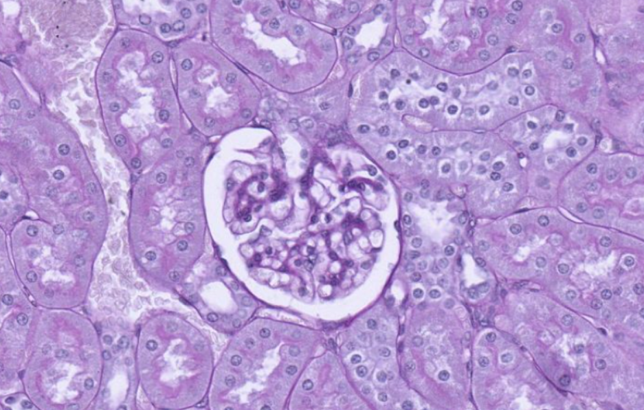 Histologia Da Piramide Renal Fisiologia Renal: Anatomia, Funções E