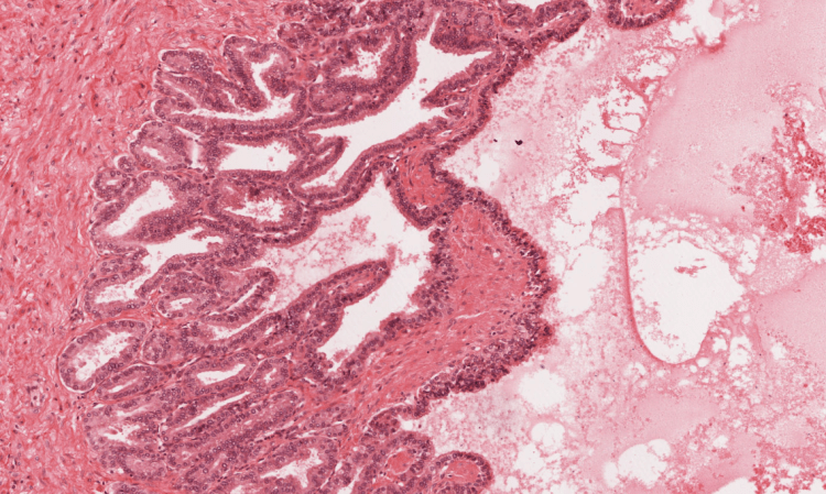 APARATO REPRODUCTOR MASCULINO – ATLAS DE HISTOLOGÍA