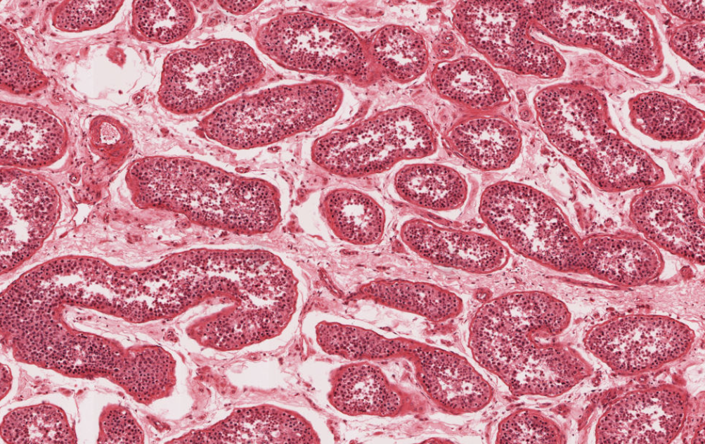 Histología Del Testículo Marcada