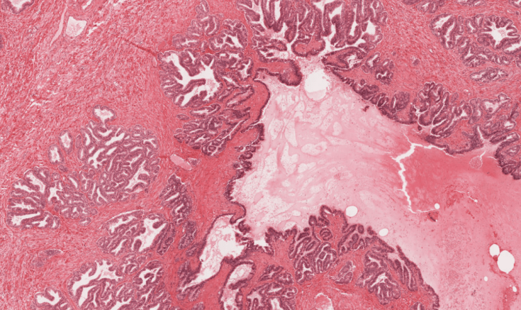 APARATO REPRODUCTOR MASCULINO – ATLAS DE HISTOLOGÍA