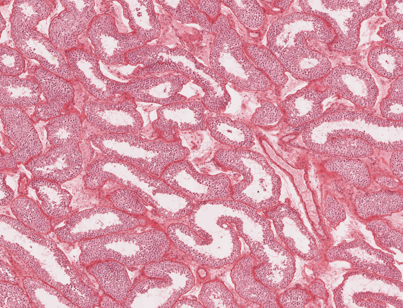 Histología Del Testículo Marcada