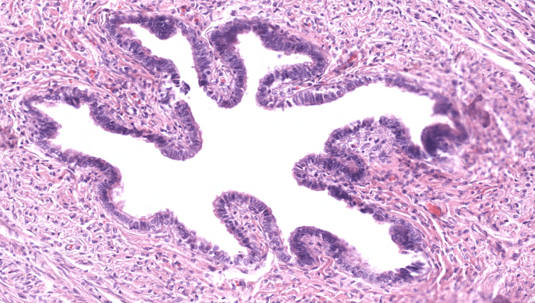 APARATO REPRODUCTOR FEMENINO – ATLAS DE HISTOLOGÍA